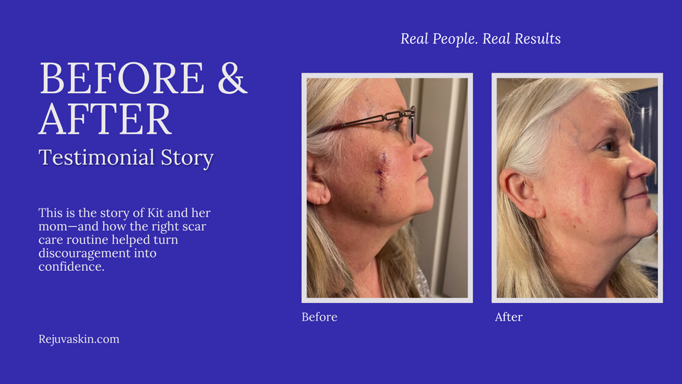 Why Do My Scars Turn Dark? The Basics Behind Scar Discoloration ...